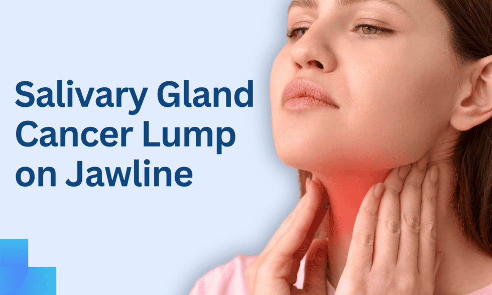 Salivary Gland Cancer Lump on Jawline | Dr. Devendra Chaukar